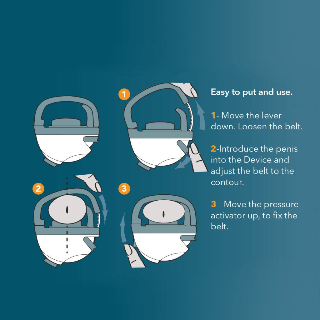 Harex Urinary Incontinence Device | Mens Health Downunder