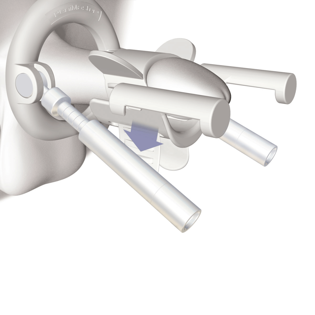 PeniMaster® Classic – Physiological Penis Expander | Mens Health Downunder