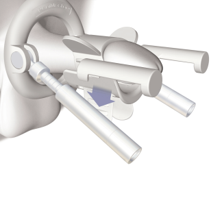 PeniMaster® Classic – Physiological Penis Expander | Mens Health Downunder