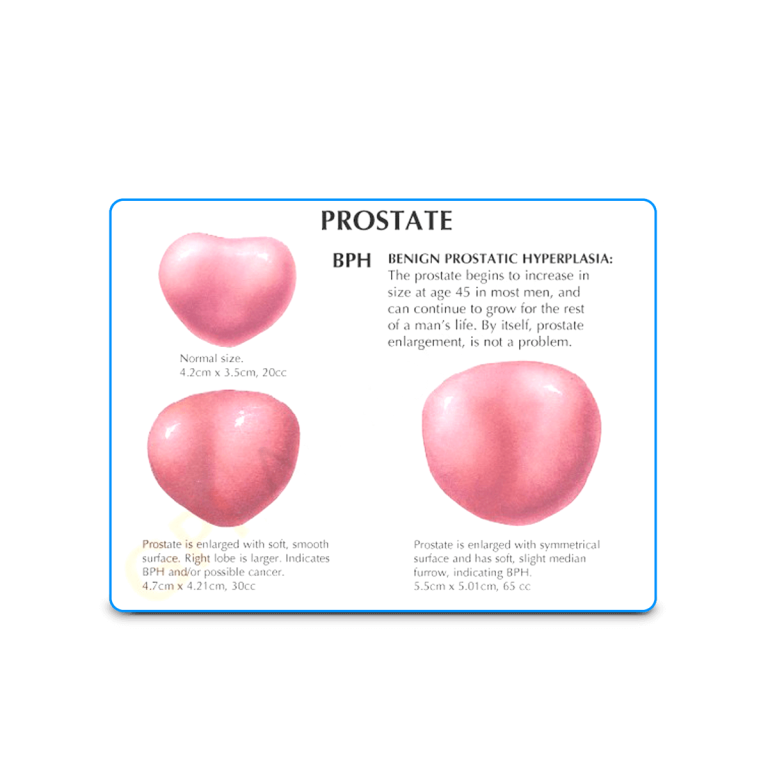 3D Male Pelvis and Prostate Model | Mens Health Downunder